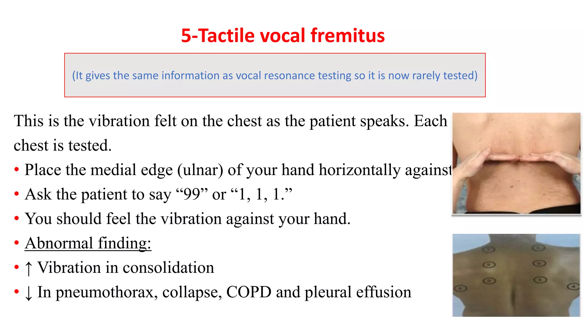Local chest examination | PPTX