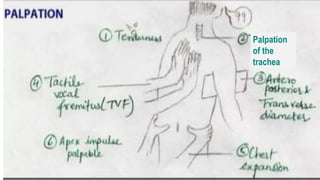 Local chest examination | PPTX
