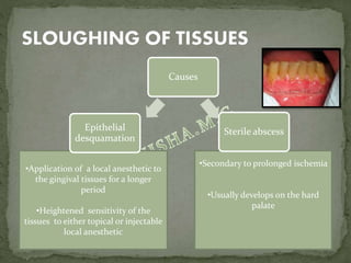 Local complications of Local Anesthesia | PPTX