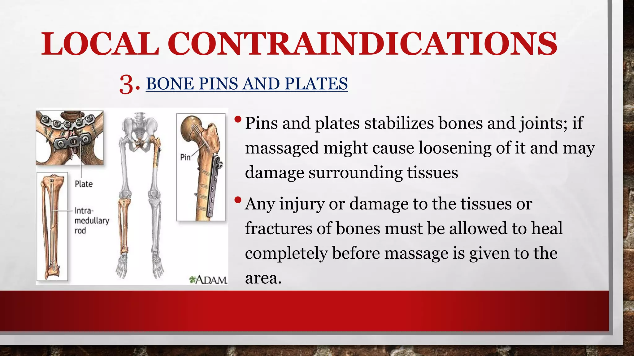 Local contraindication 2020 | PDF