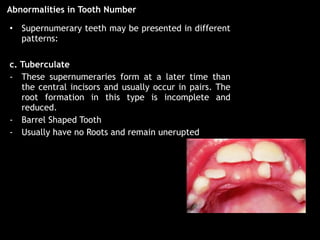 Local / Dental causes of Malocclusion | PPT