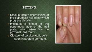 local disorders of the nail apparatus.pptx