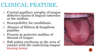 Local disorder of tongue.pptx