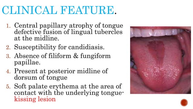 Local disorder of tongue.pptx