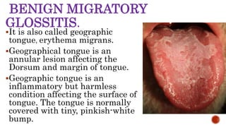 Local disorder of tongue.pptx