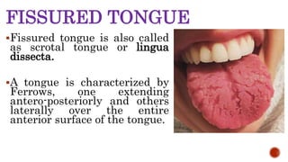 Local disorder of tongue.pptx