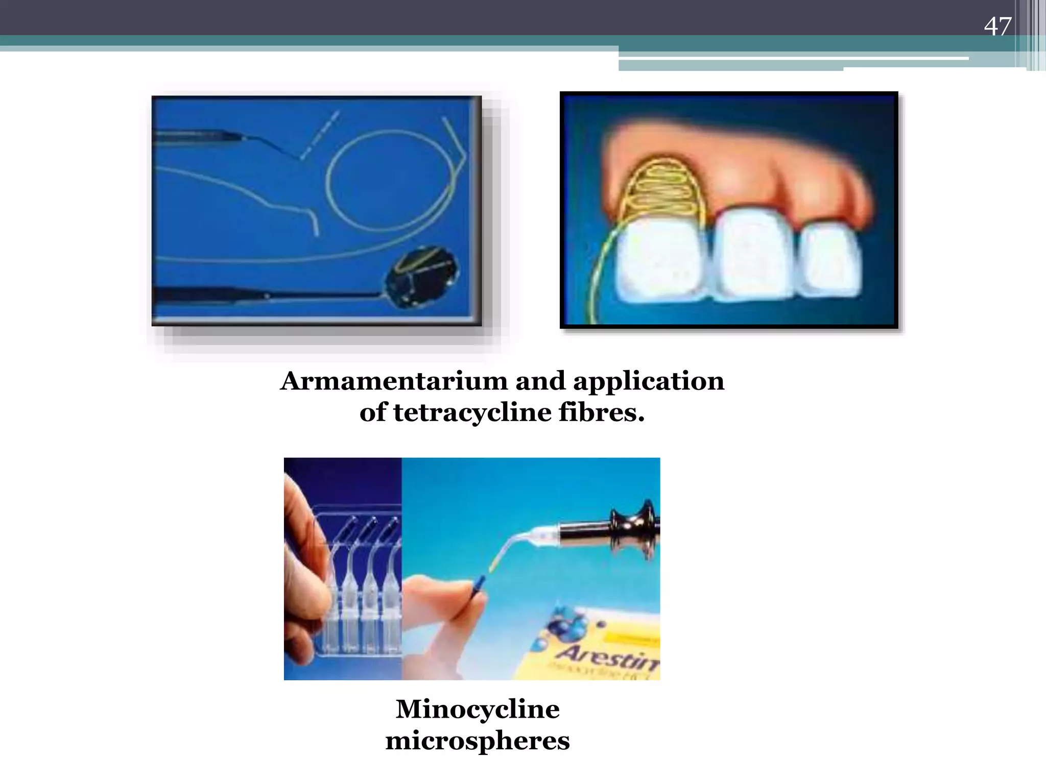 Local Drug Delivery | PPTX