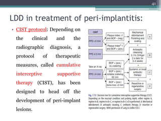 Local Drug Delivery | PPT