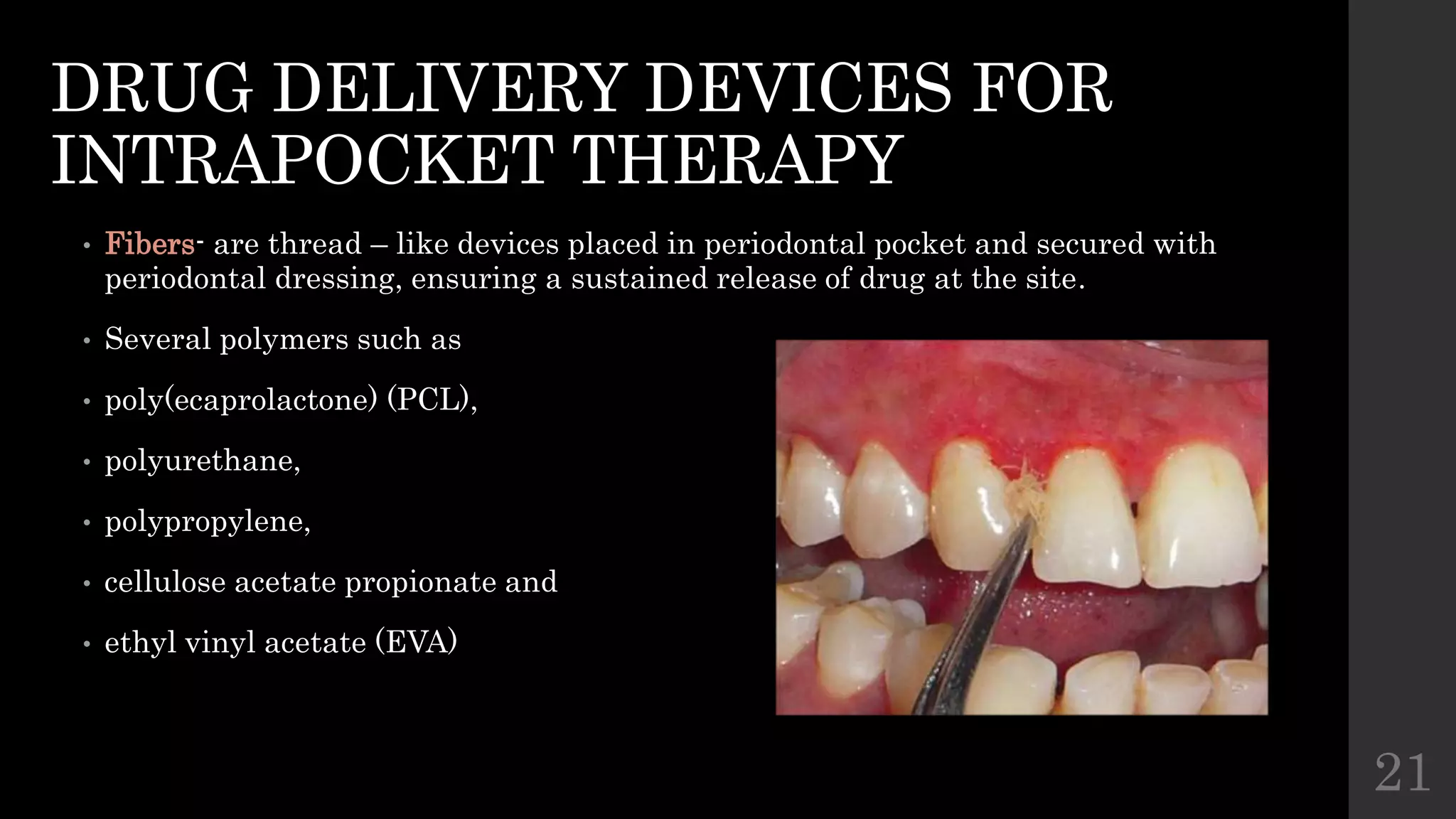 Local drug delivery system | PPTX