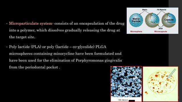 Local drug delivery system | PPTX