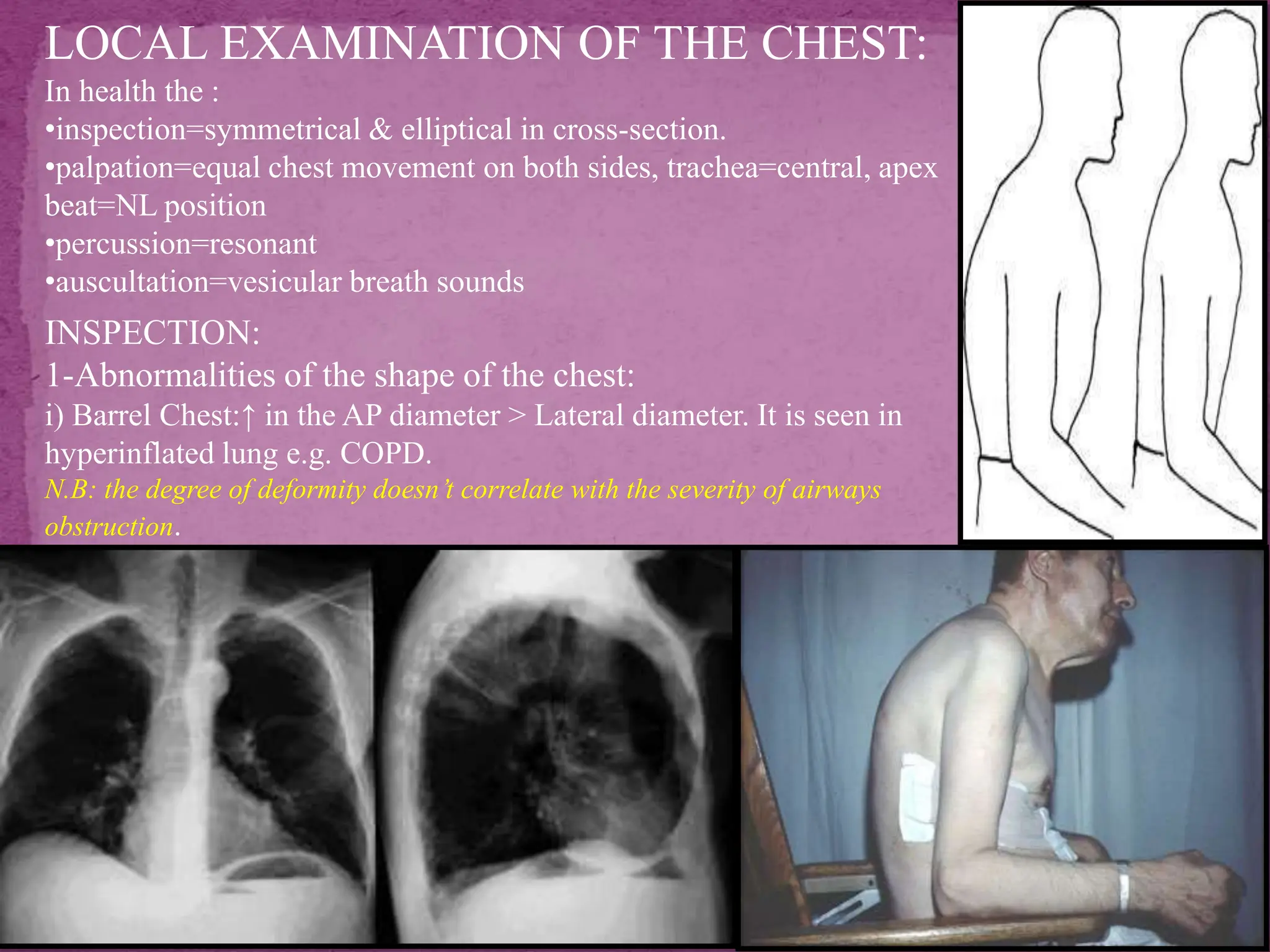 Local Exaination of the Respiratory System.pptx