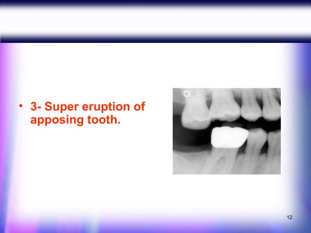 Local factors affect tooth eruption | PPT | Dental Health | Diseases ...