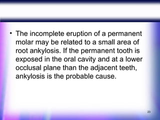 Local factors affect tooth eruption | PPT