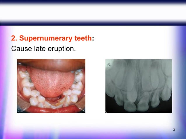 Local factors affect tooth eruption | PPT | Dental Health | Diseases ...