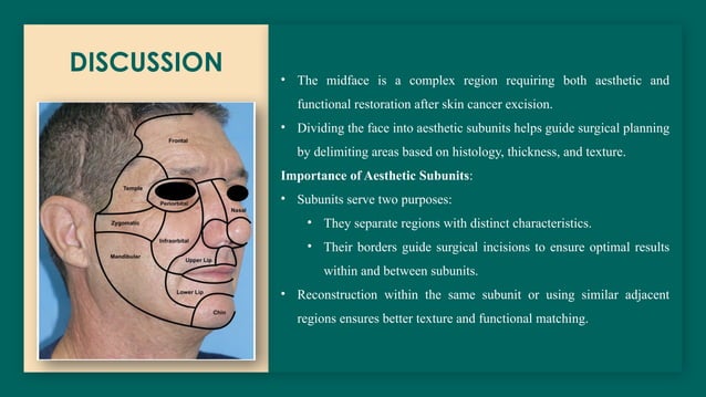 local flap IN HEAD AND MAXILLOFACIAL SUR | PPTX