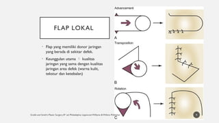 local flap definition and classification.pptx