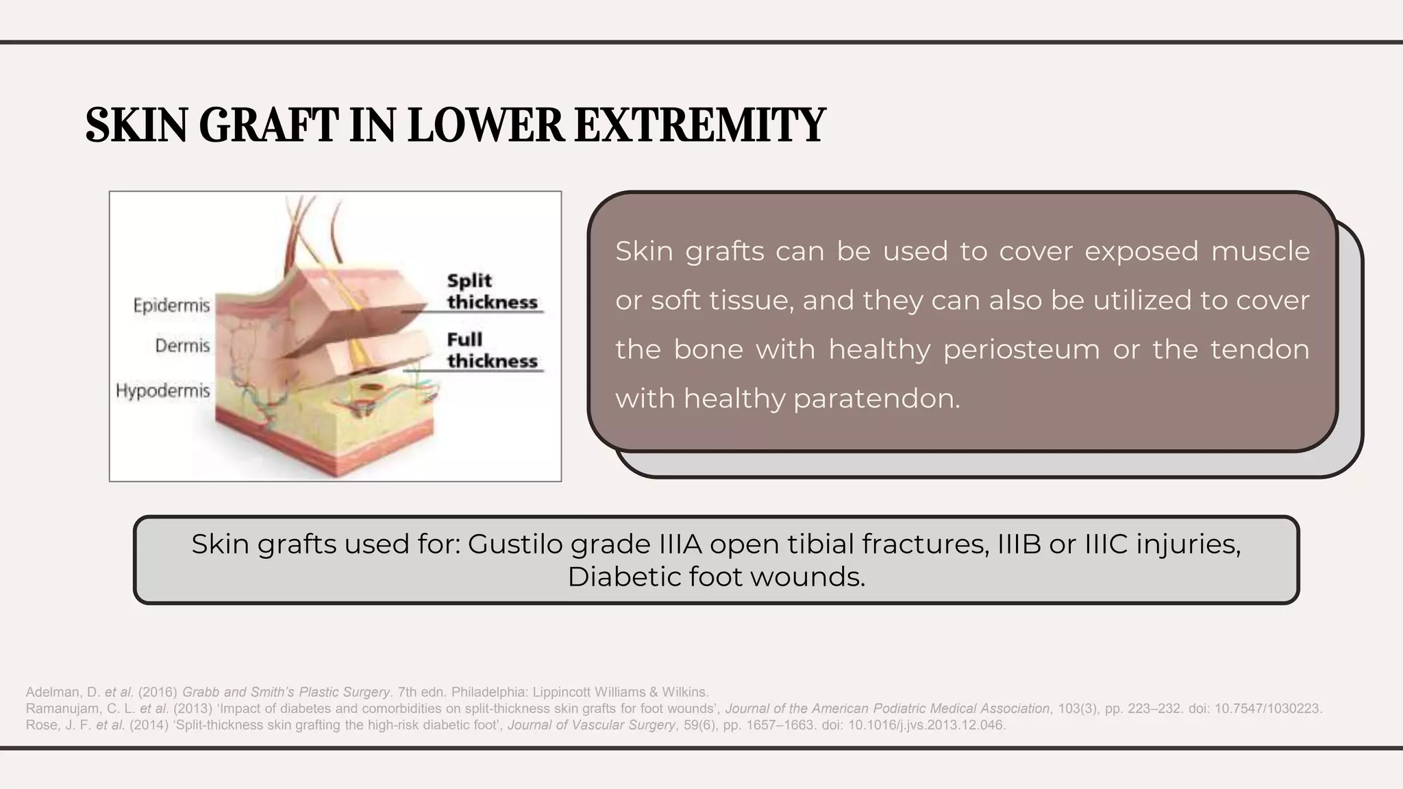 Local Flap of Lower Extremity.pptx