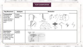 Local Flap of Lower Extremity.pptx