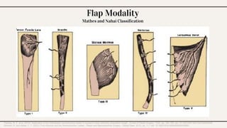 Local Flap of Lower Extremity.pptx