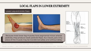 Local Flap of Lower Extremity.pptx