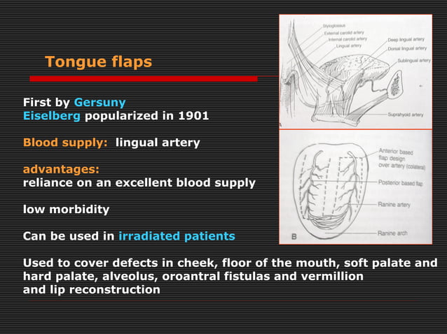 Local flaps | PPT | First Aid | Injuries