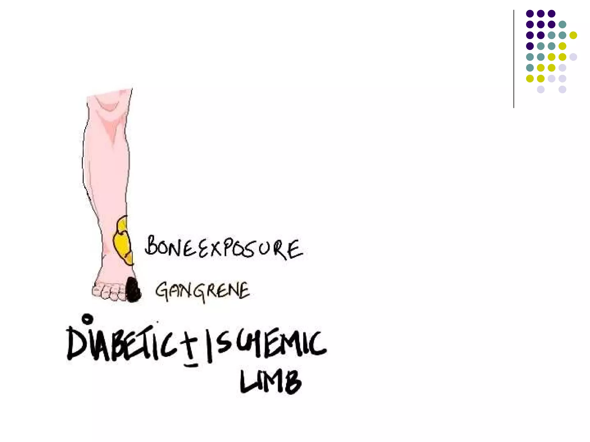 Local Flaps For Lower Limb Reconstruction Version1 | PPT