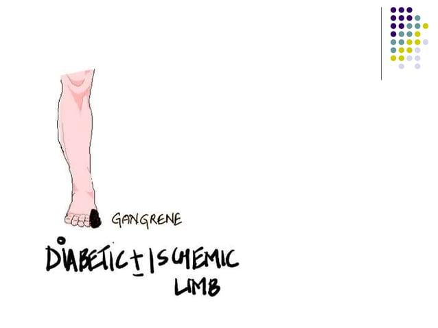 Local Flaps For Lower Limb Reconstruction Version1 | PPT