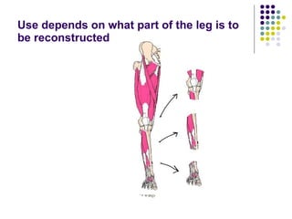 Local Flaps For Lower Limb Reconstruction Version1 | PPT