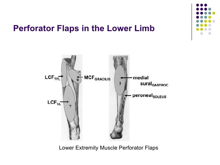 Local Flaps For Lower Limb Reconstruction Version1