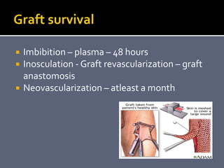 Local flaps in ent | PPTX