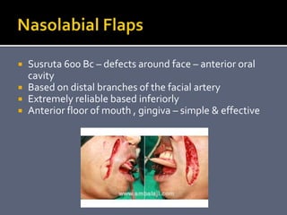 Local flaps in ent | PPTX