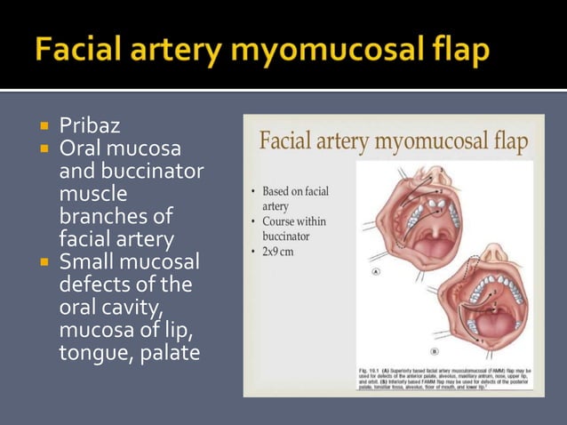 Local flaps in ent | PPT