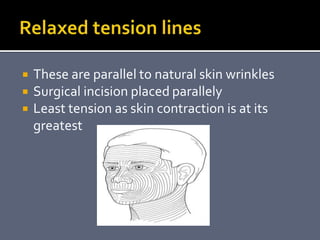 Local flaps in ent | PPTX