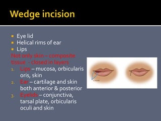 Local flaps in ent | PPTX