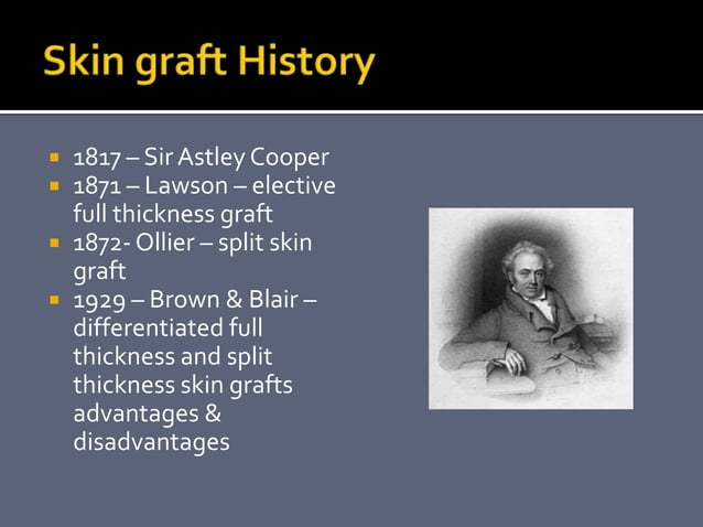 Local flaps in ent | PPTX | Death, Injury, or Military Conflict ...