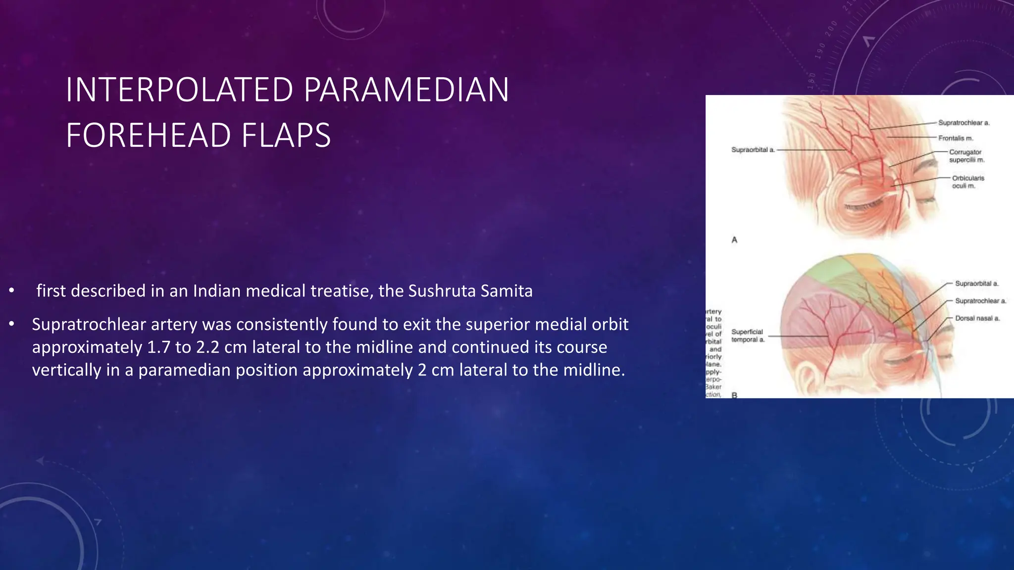 local flaps in head and neck surgery -Maroti.pptx