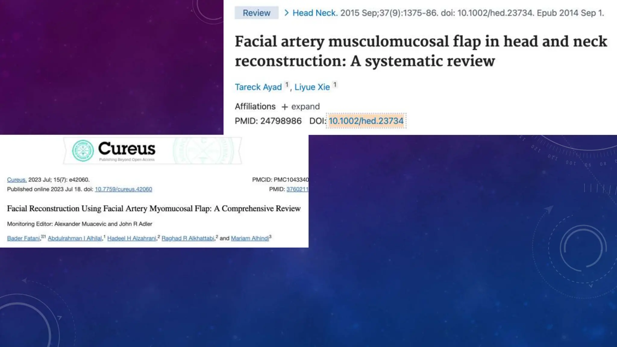 local flaps in head and neck surgery -Maroti.pptx