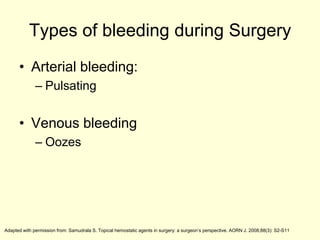Local hemostatic agents(2) | PPT