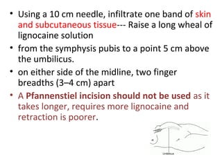 Local infiltrative anesthesia for cesarean section | PPT