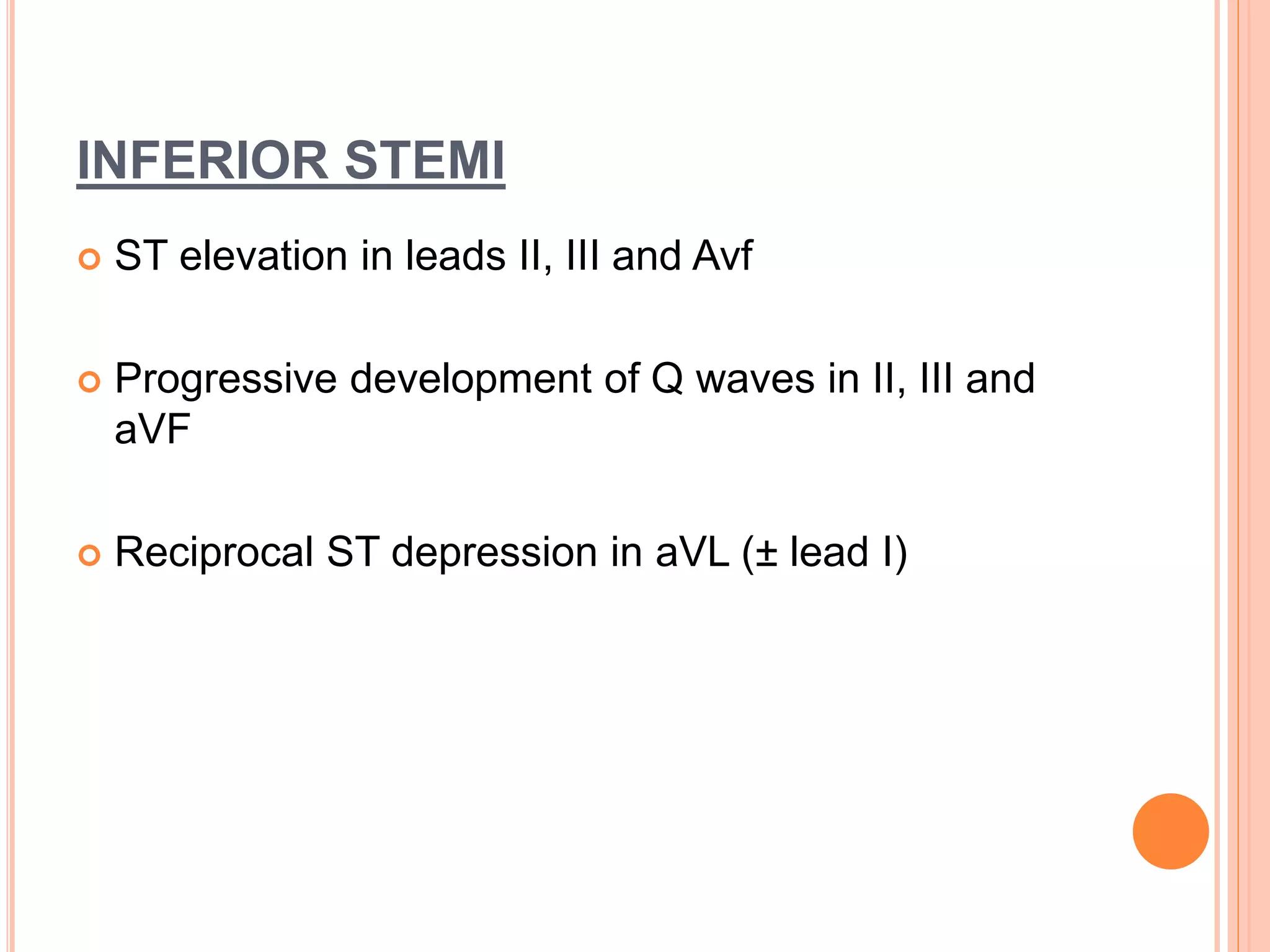 Localisation of Myocardial Infarction | PPTX