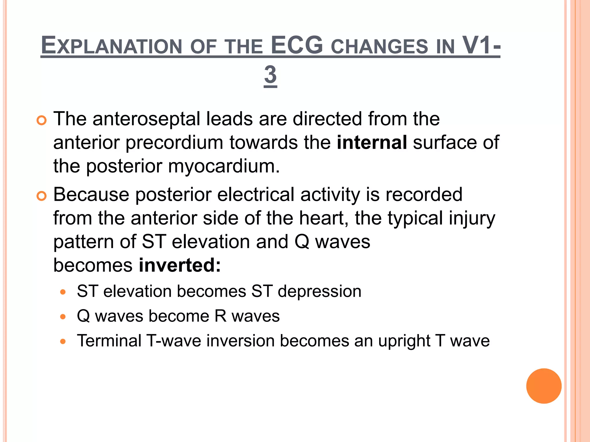 Localisation of Myocardial Infarction | PPTX