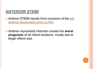 Localisation of Myocardial Infarction | PPTX