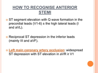 Localisation of Myocardial Infarction | PPTX