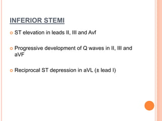 Localisation of Myocardial Infarction | PPTX