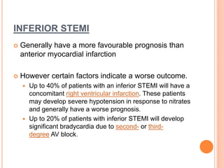 Localisation of Myocardial Infarction | PPTX