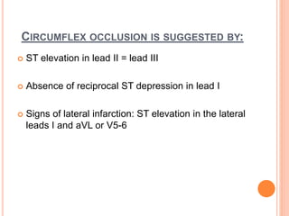 Localisation of Myocardial Infarction | PPTX