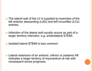 Localisation of Myocardial Infarction | PPTX