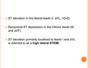 Localisation of Myocardial Infarction | PPTX