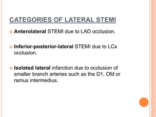 Localisation of Myocardial Infarction | PPTX
