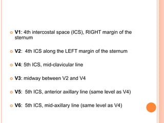 Localisation of Myocardial Infarction | PPTX
